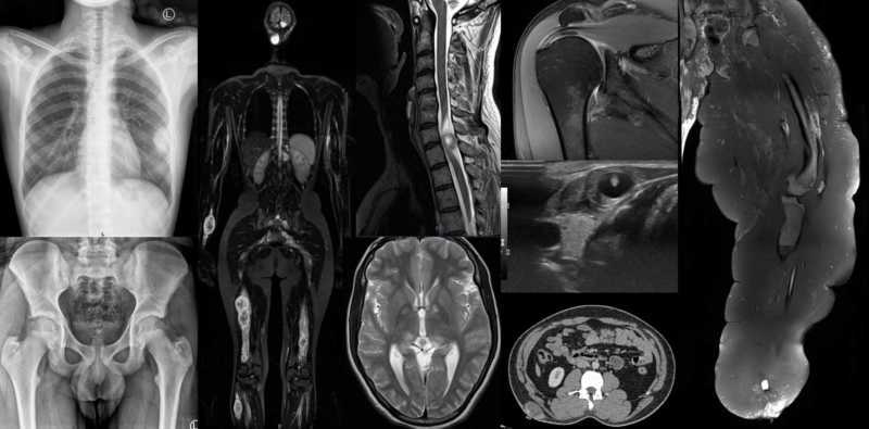 Radiology Spotters Set 5 | Radiology Spotters | RadioGyan.com