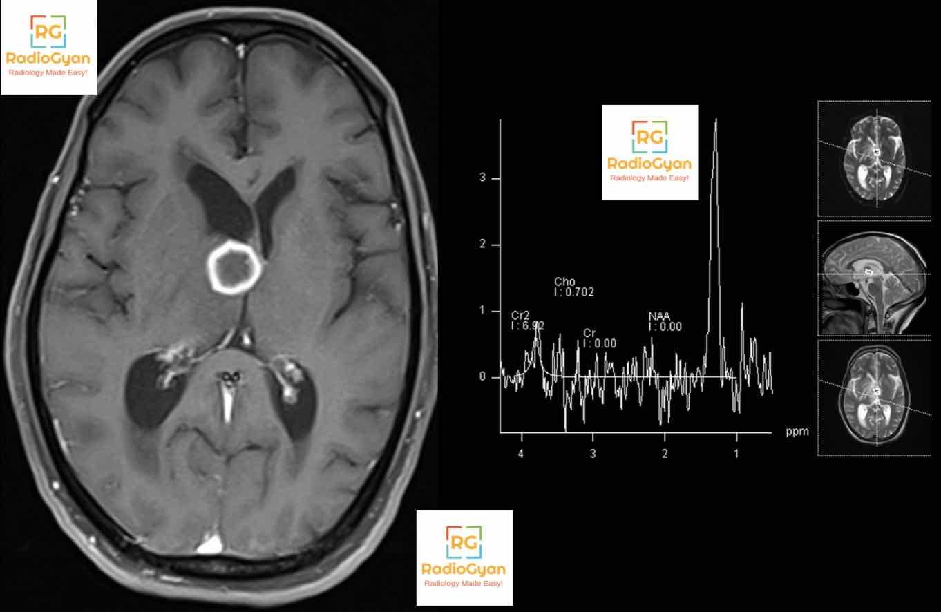 Radiology Spotters Set 15 | RadioGyan.com