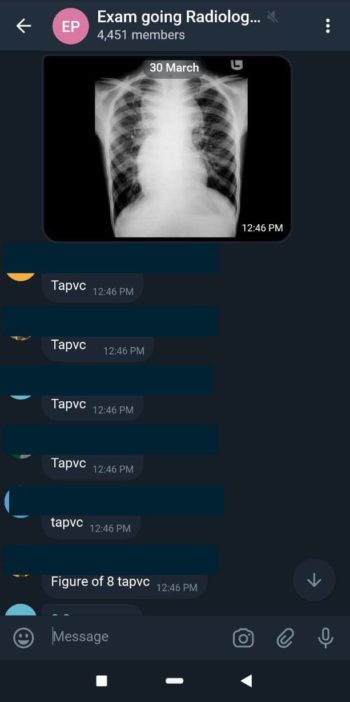 Radiology Spotters (Quiz) Cases to Ace your Board Exams – RadioGyan