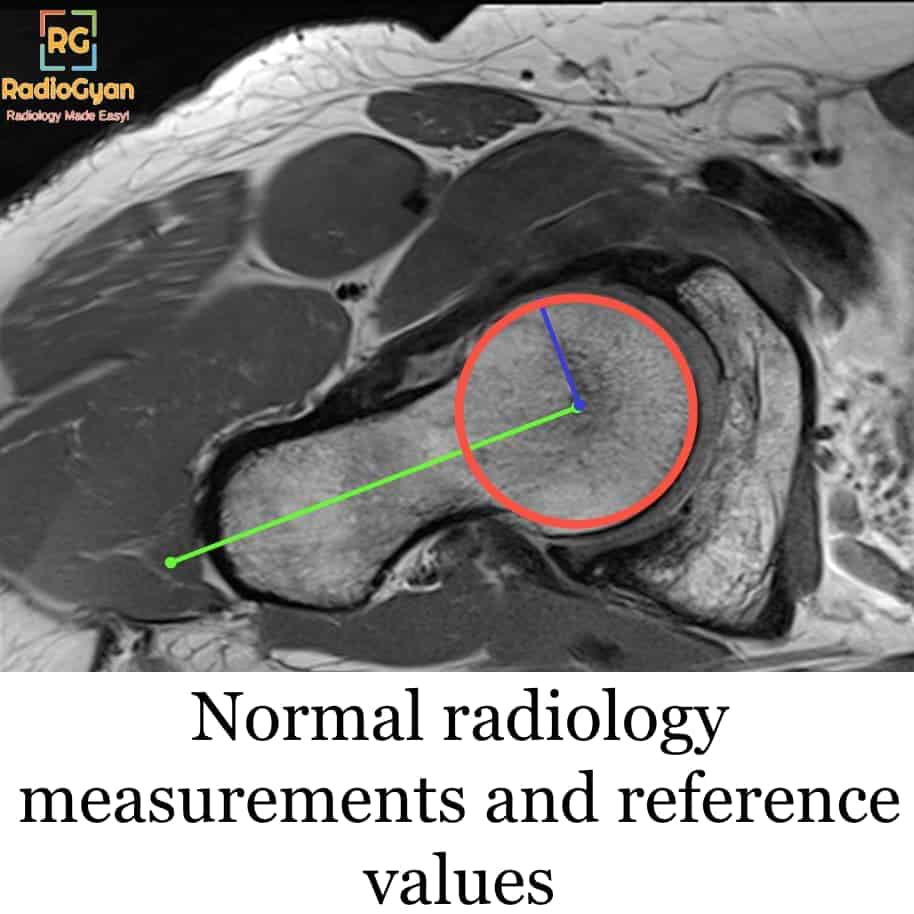 Normal radiology measurements and reference values (2020) | Radiogyan