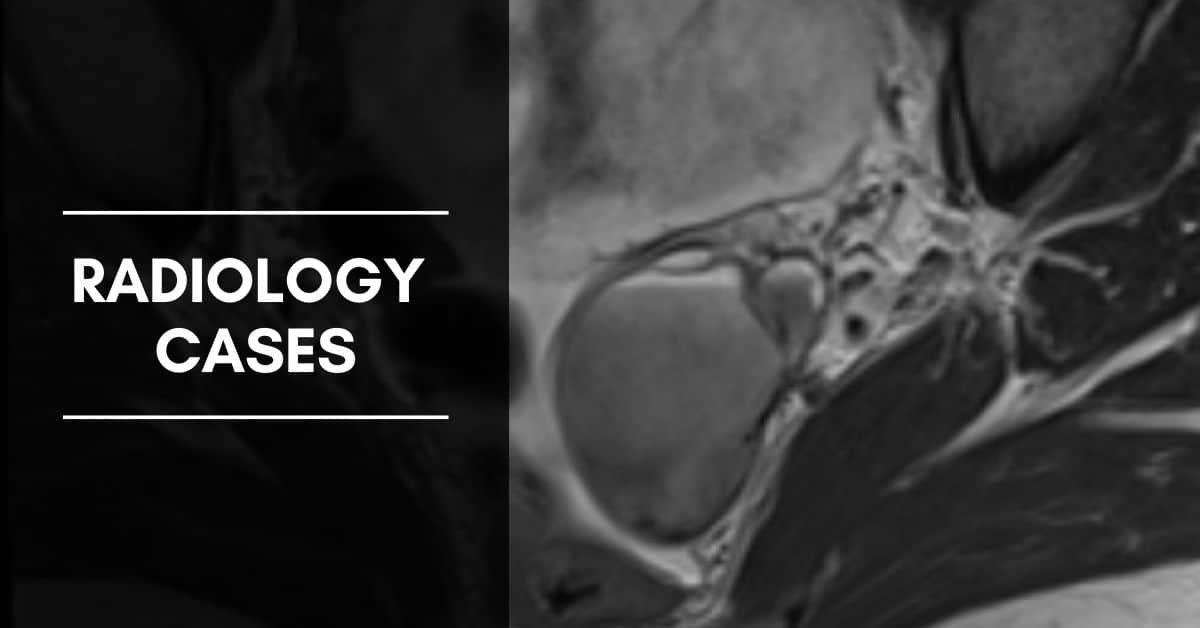 FRCR Exam : Tips , Tricks Mock tests and more | RadioGyan.com