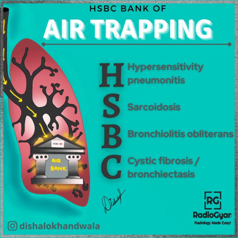 Causes of Air Trapping on CT - Visual Mnemonics