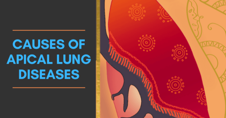 Causes of Apical Lung Fibrosis - Visual Mnemonics - RadioGyan