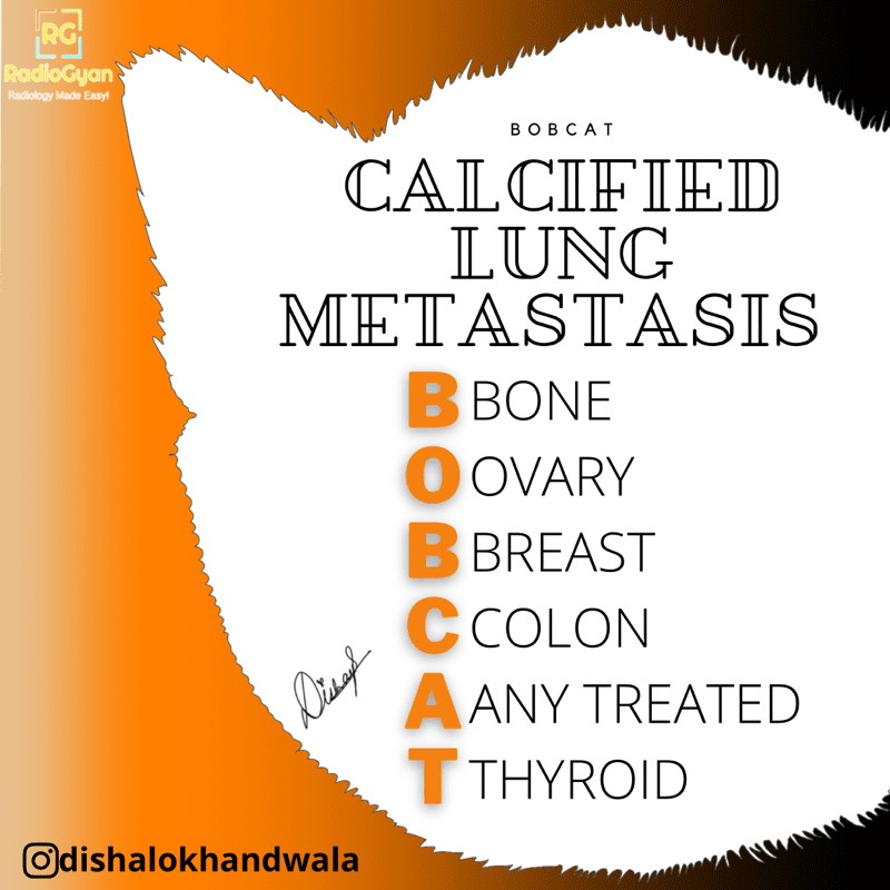Causes Of Calcified Lung Metastasis - Visual Mnemonics