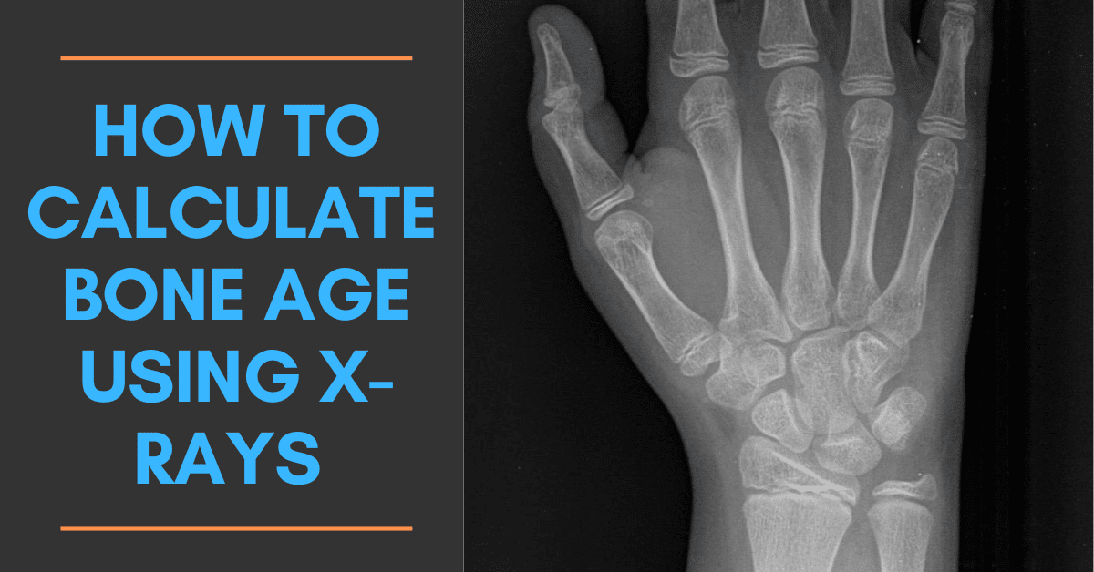 Pediatric Bone Age Calculator