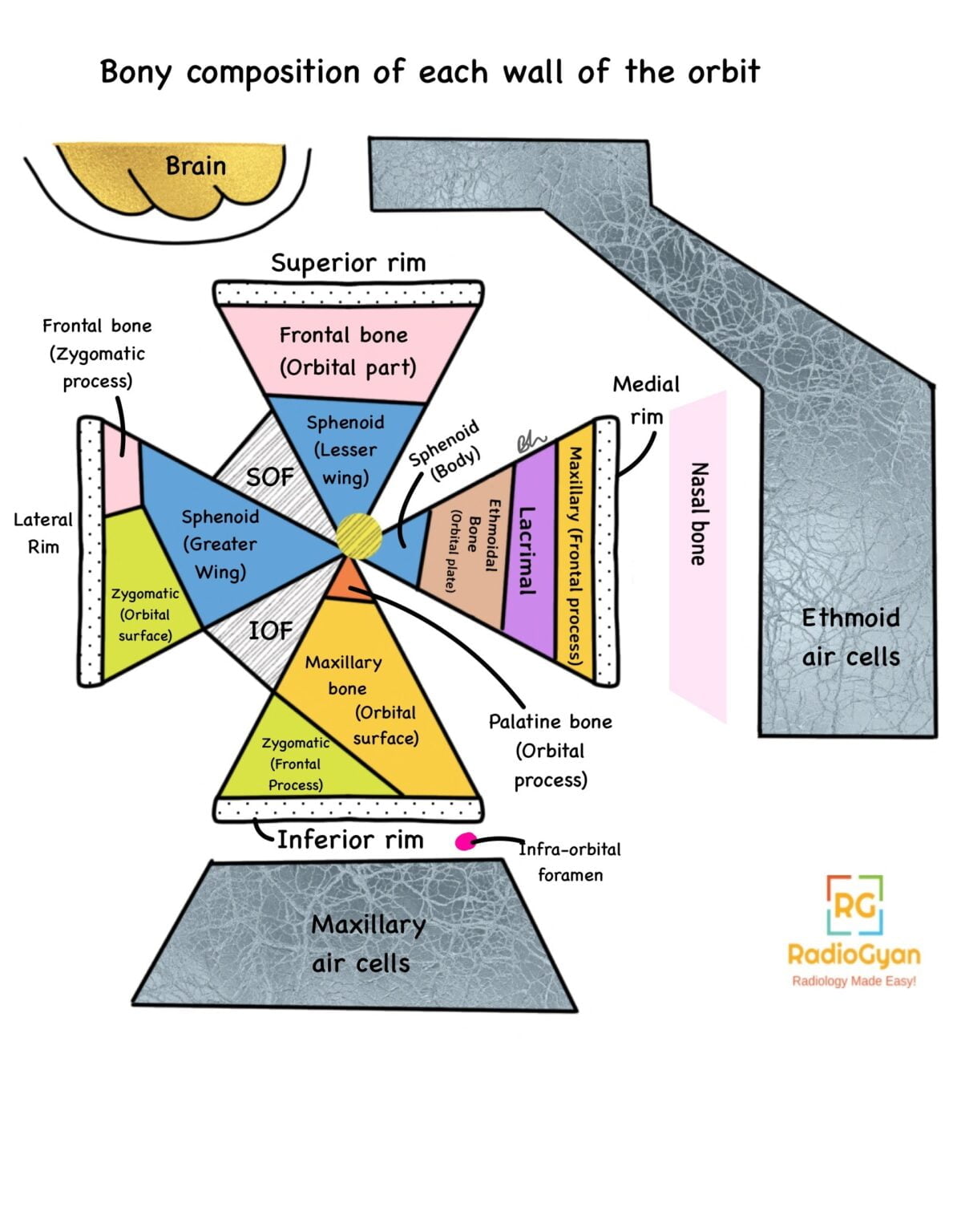 Blow out fracture of the Orbit | Radiology Case