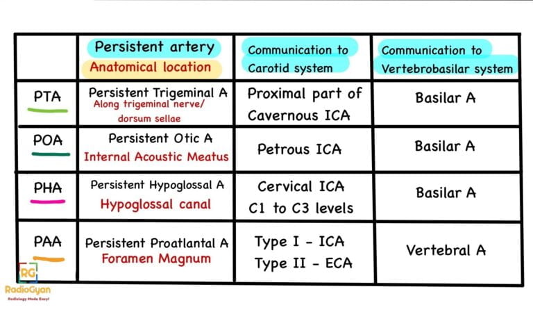 Persistent Trigeminal Artery | Radiology Case