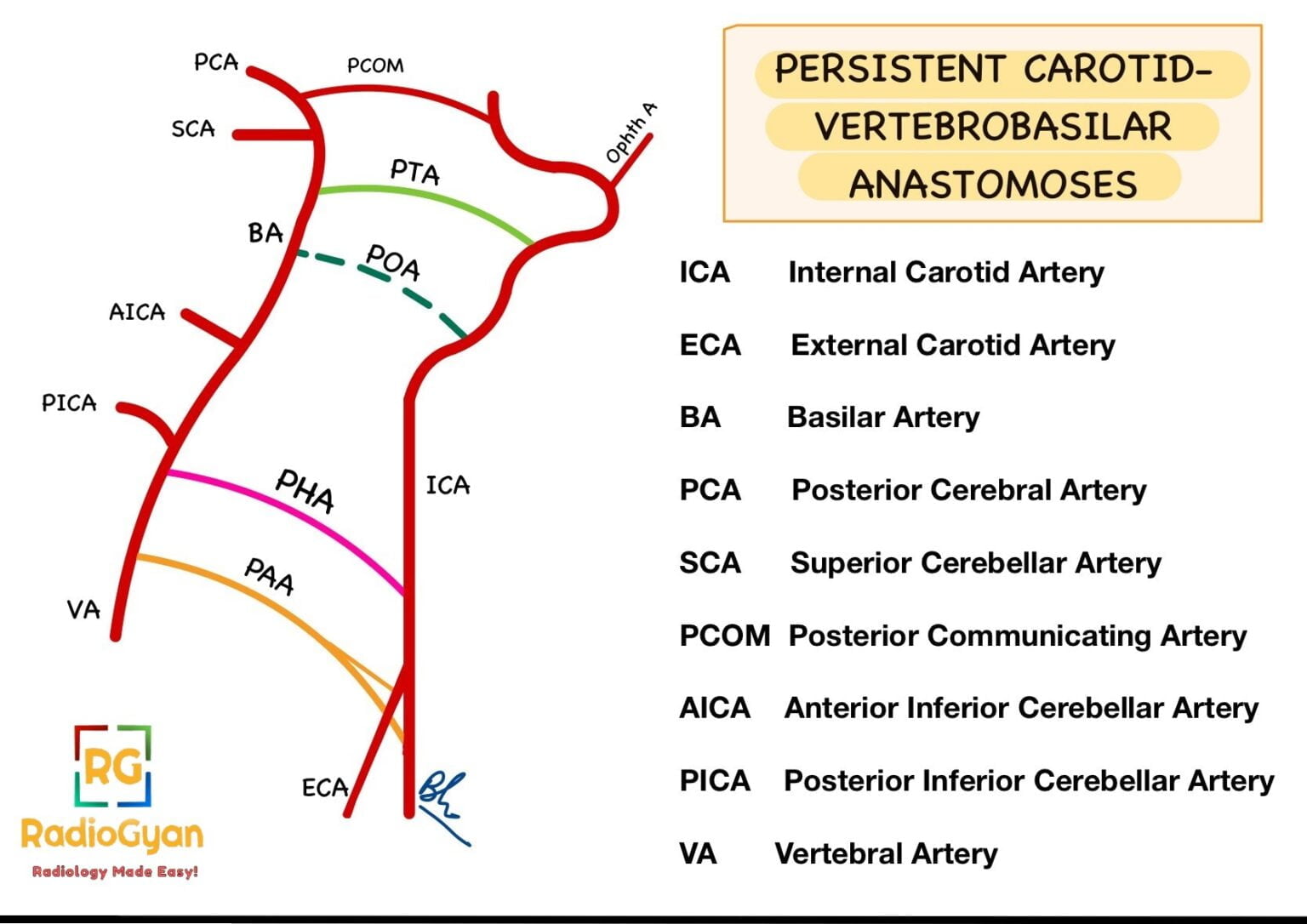 Persistent Trigeminal Artery | Radiology Case