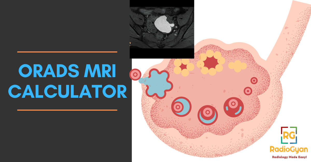 O-RADS MRI Calculator for Ovarian Cysts