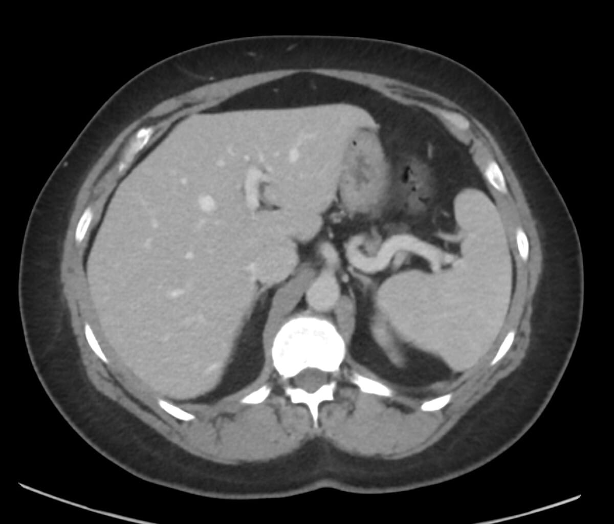 Etymology of Imaging Planes - Axial, Sagittal and Coronal