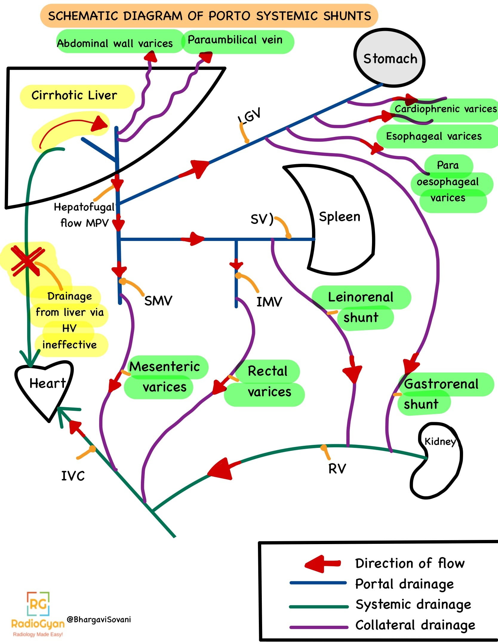 Cirrhosis and Portal Hypertension