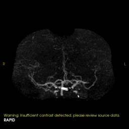 Interventional Radiology - All Your Questions Answered | Guides ...