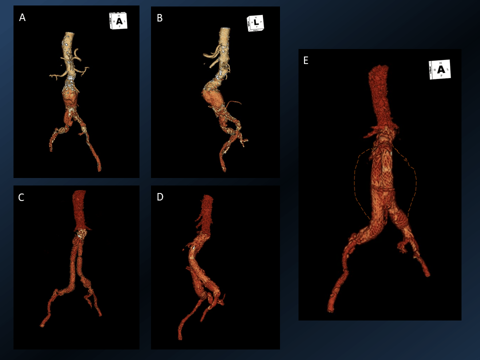 Interventional Radiology All Your Questions Answered Guides
