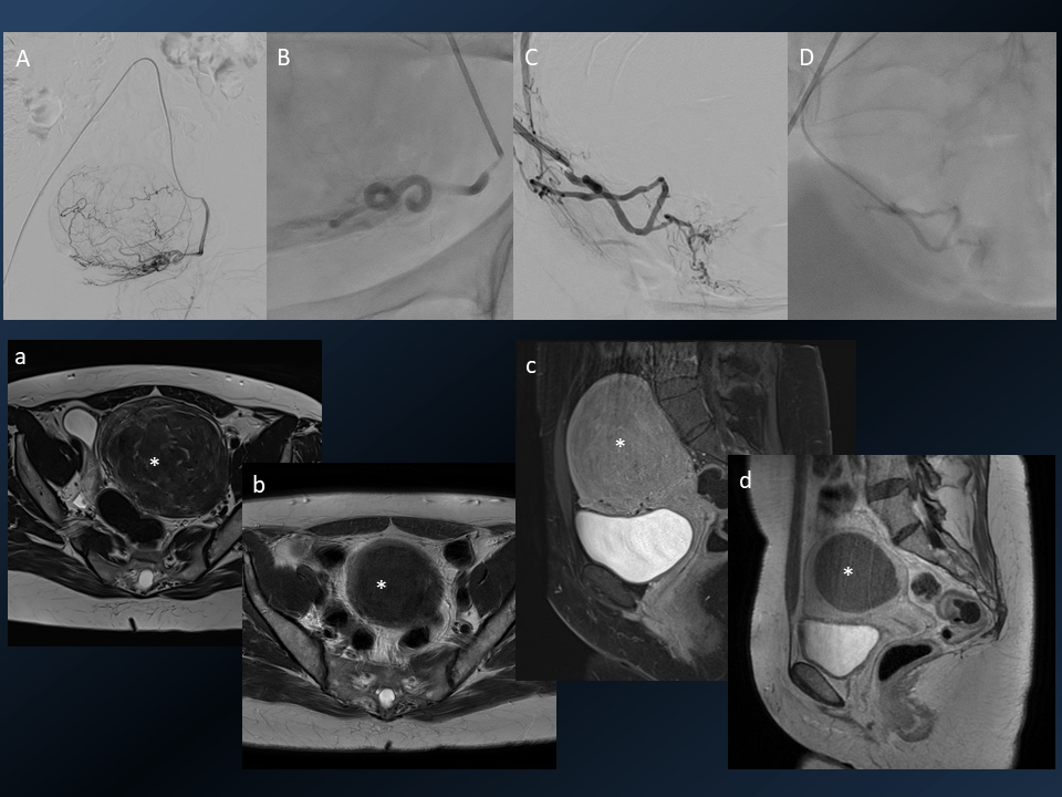 Interventional Radiology - All Your Questions Answered | Guides | RadioGyan
