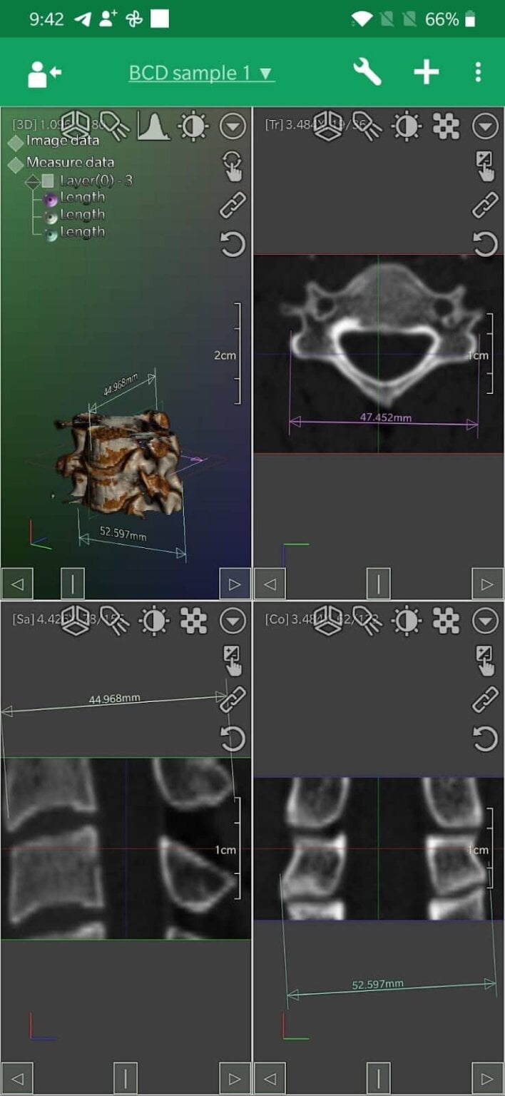 Best DICOM Viewers for Windows, MacOS, Web & Mobile - 2024