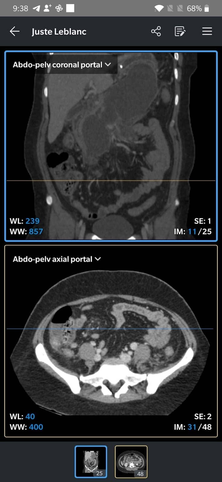 Best DICOM Viewers for Windows, MacOS, Web & Mobile - 2024
