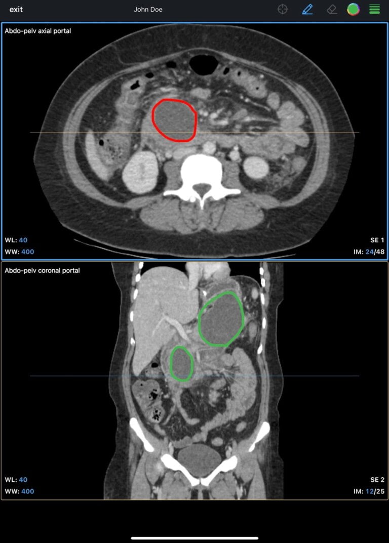 Best DICOM Viewers for Windows, MacOS, Web & Mobile - 2024