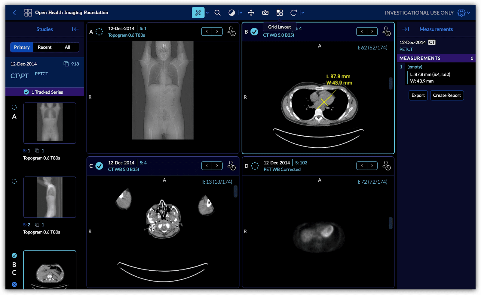 Best DICOM Viewers for Windows, MacOS, Web & Mobile - 2024