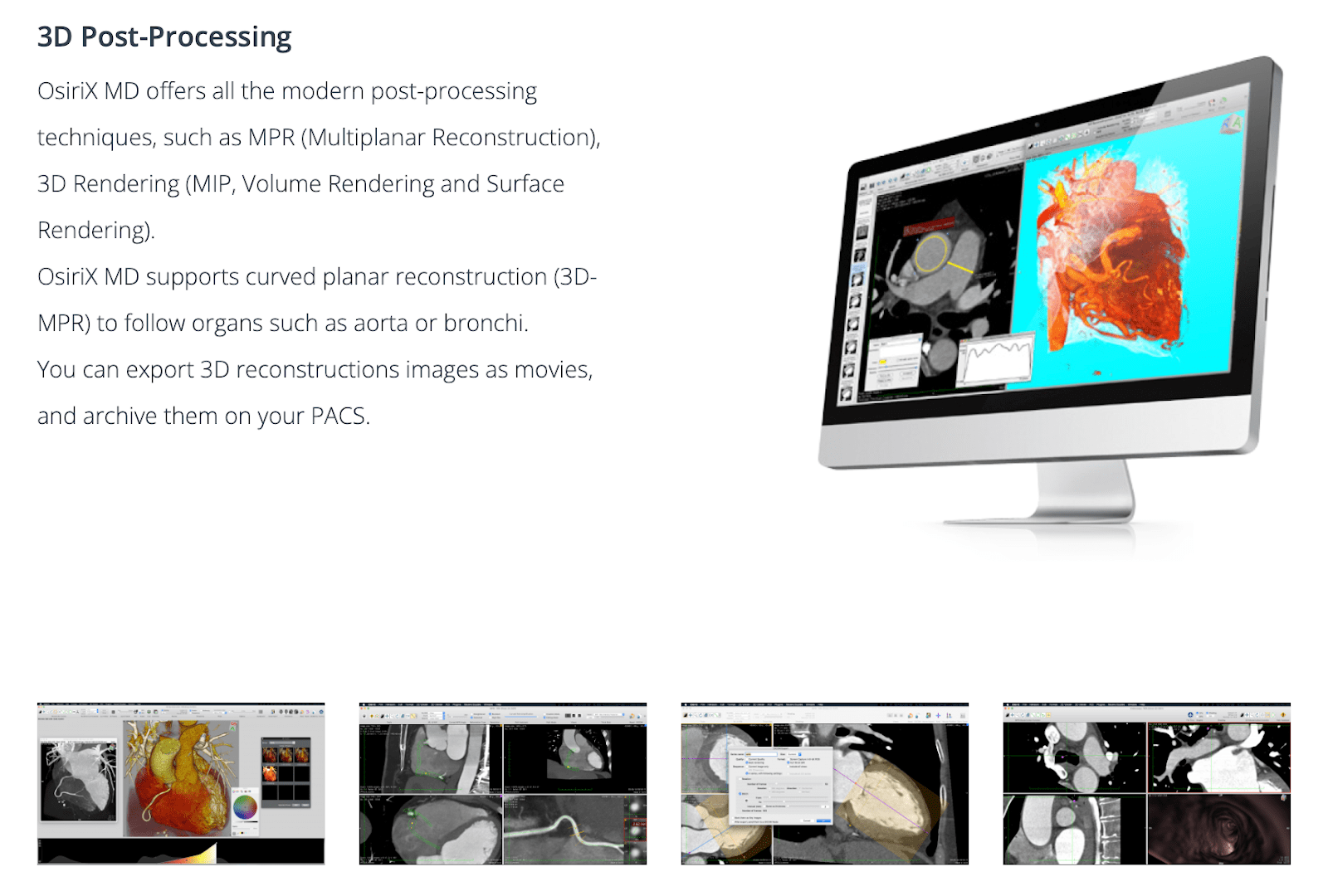 Best DICOM Viewers for Windows, MacOS, Web & Mobile - 2024