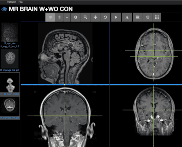 Best DICOM Viewers for Windows, MacOS, Web & Mobile - 2024