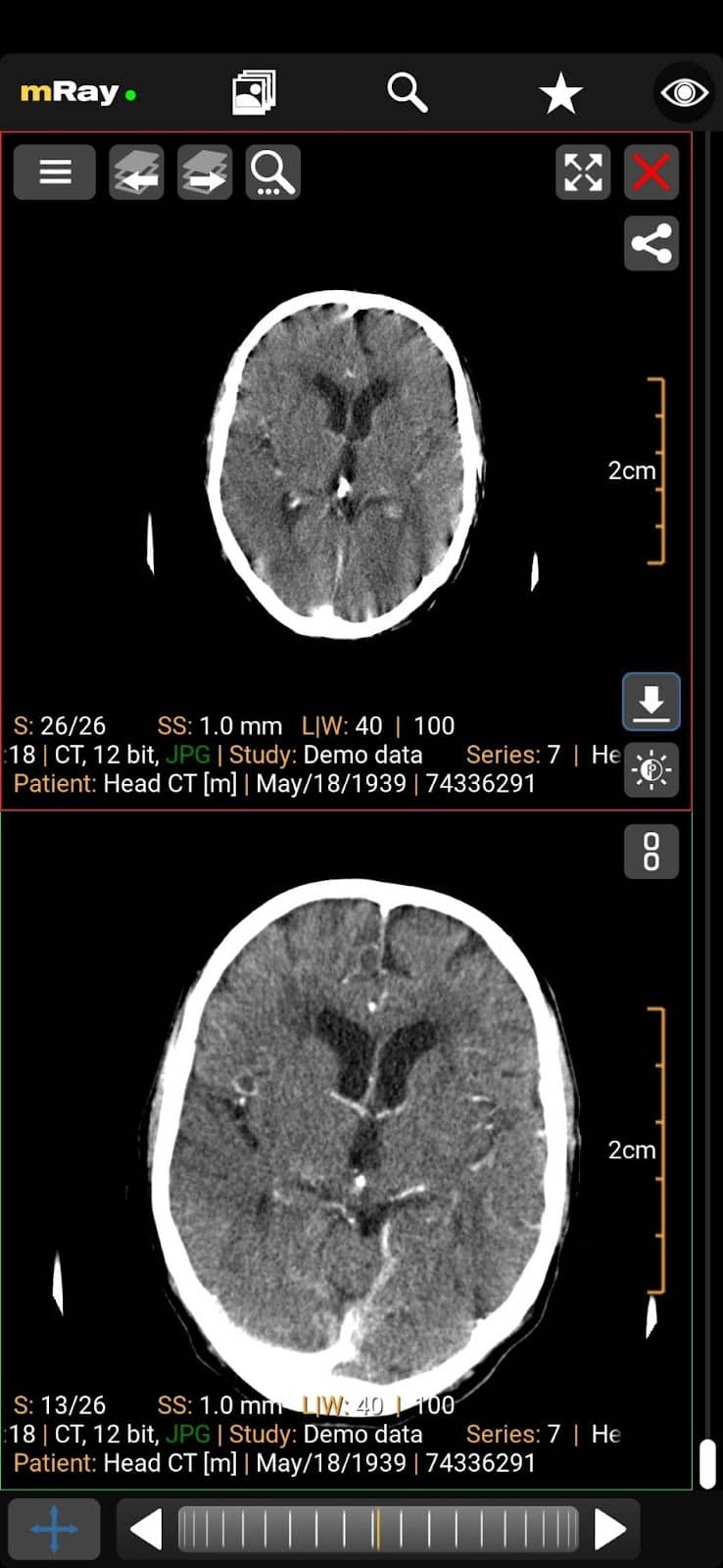 Best DICOM Viewers for Windows, MacOS, Web & Mobile - 2024