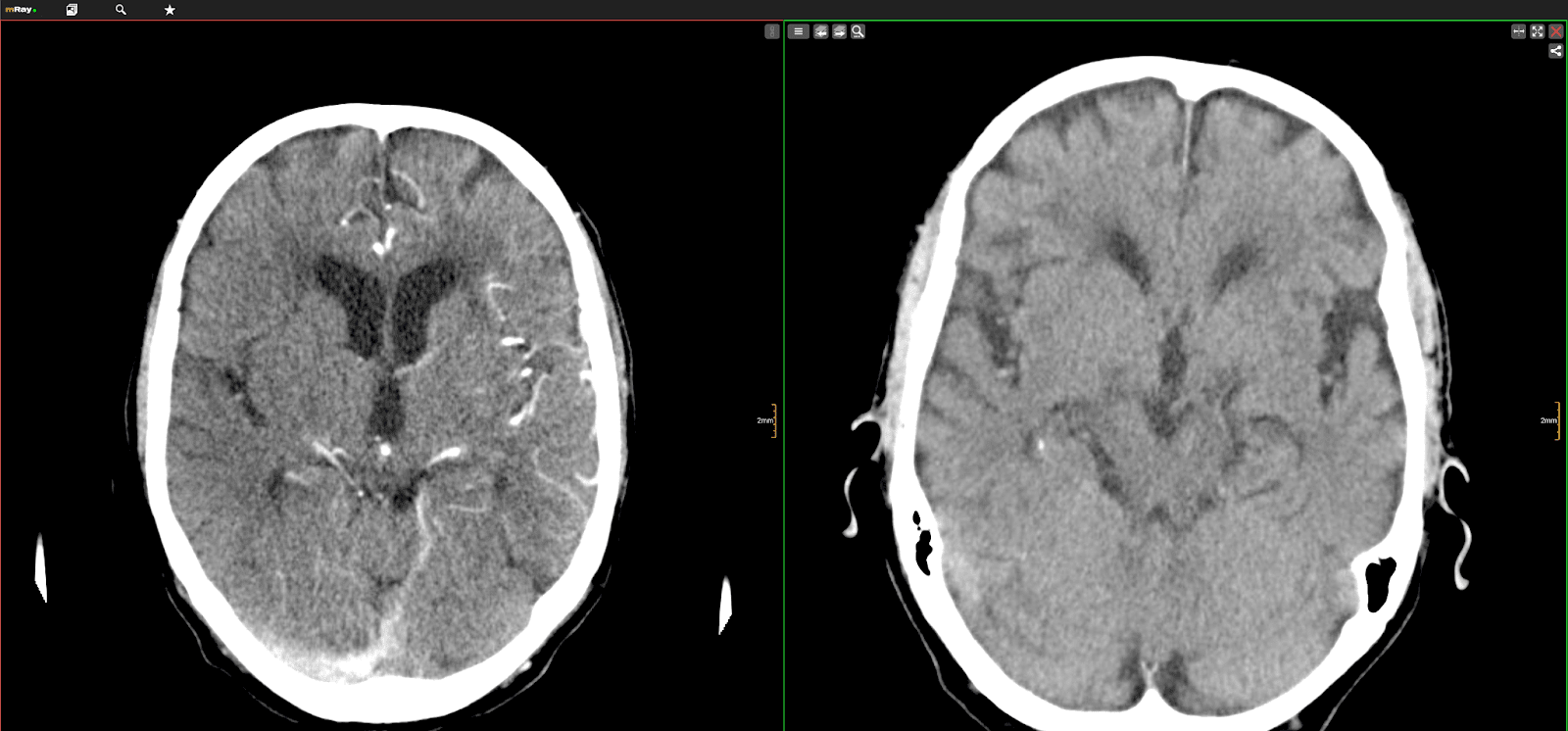 Best DICOM Viewers for Windows, MacOS, Web & Mobile - 2024