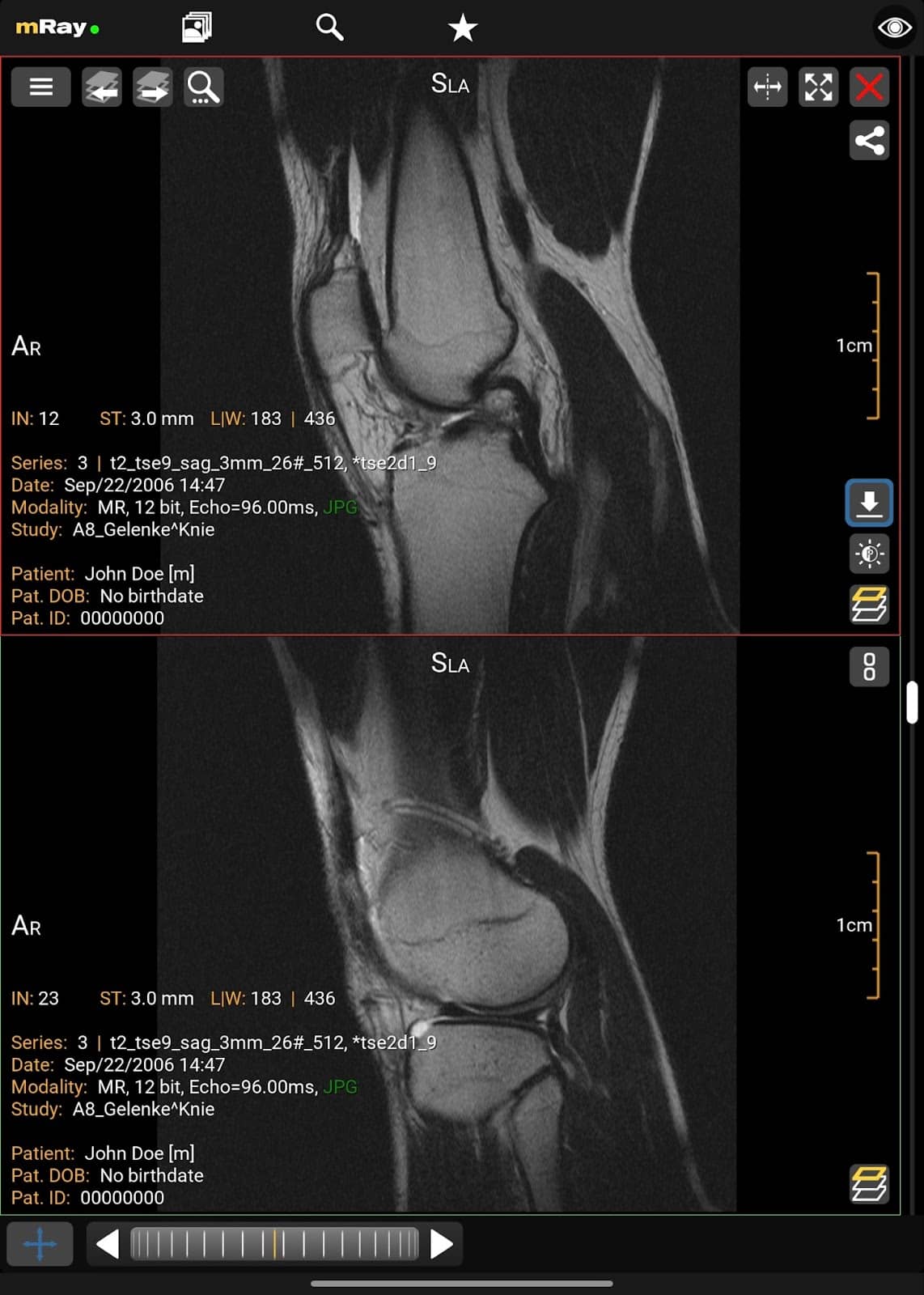 Best DICOM Viewers for Windows, MacOS, Web & Mobile - 2024